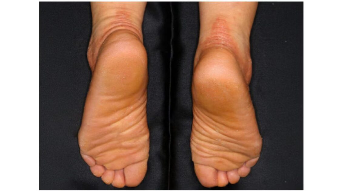 Dévoilez l'origine d'une odeur désagréable des pieds : découvrez enfin ...